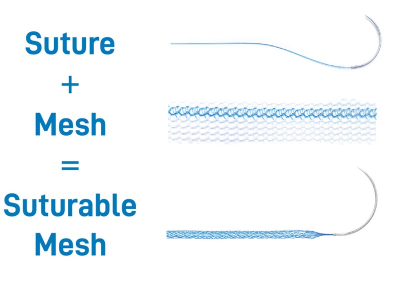 Duramesh Mesh Suture - Eurosurgical