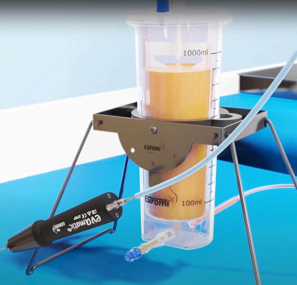 NLF2 kit - large volume Fat harvesting system - Eurosurgical